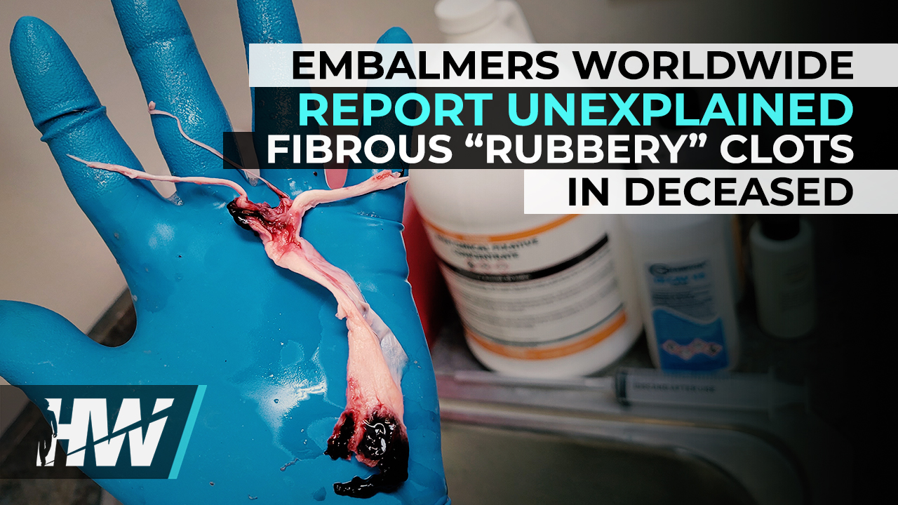 EMBALMERS WORLDWIDE REPORT UNEXPLAINED FIBROUS “RUBBERY” CLOTS IN ...